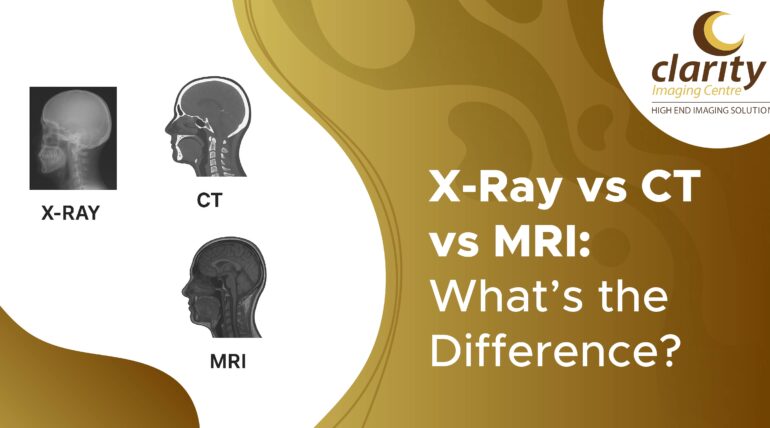 Difference Between X-Ray, CT Scan and MRI Explained