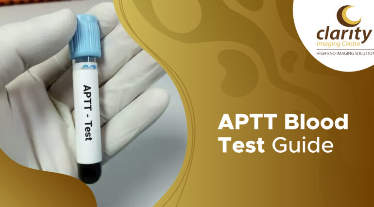 APTT Test: Purpose, Procedure and Normal Range Guide